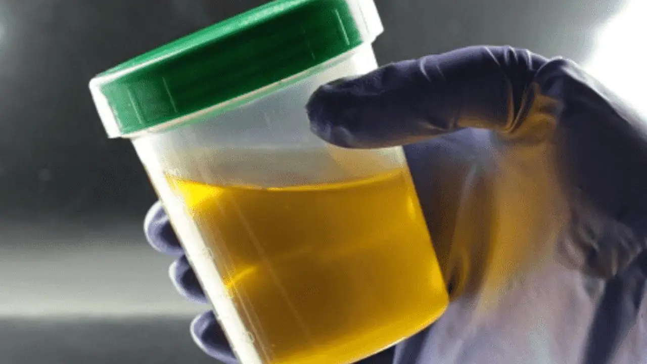 How to Recycle Urine [5 Ways]